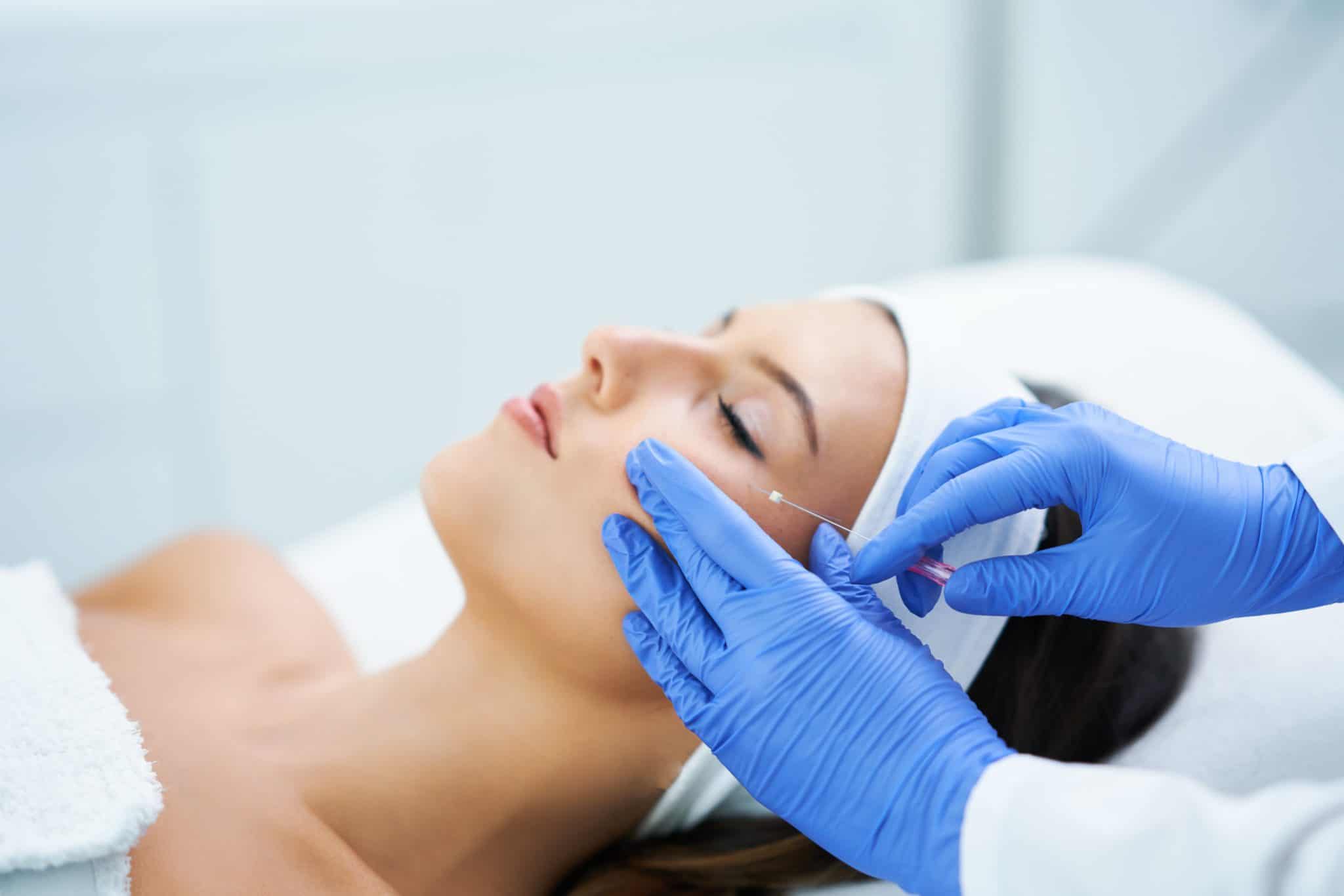 hat To Expect During A PDO Thread Lift Procedure